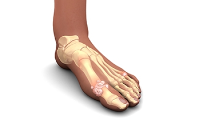 Ankle N Foot Podiatrist Foot Doctor Chicago Elmhurst And Bartlett Il
